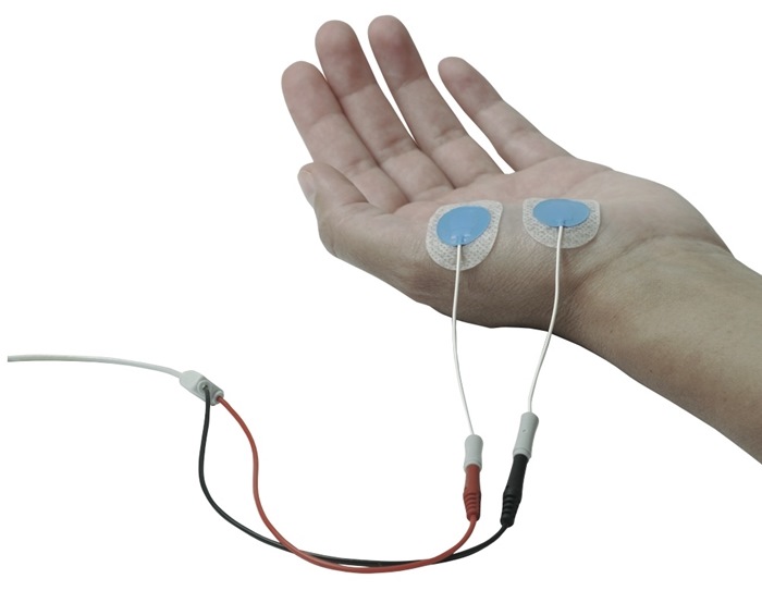 NCS - Nerve Conduction Studies